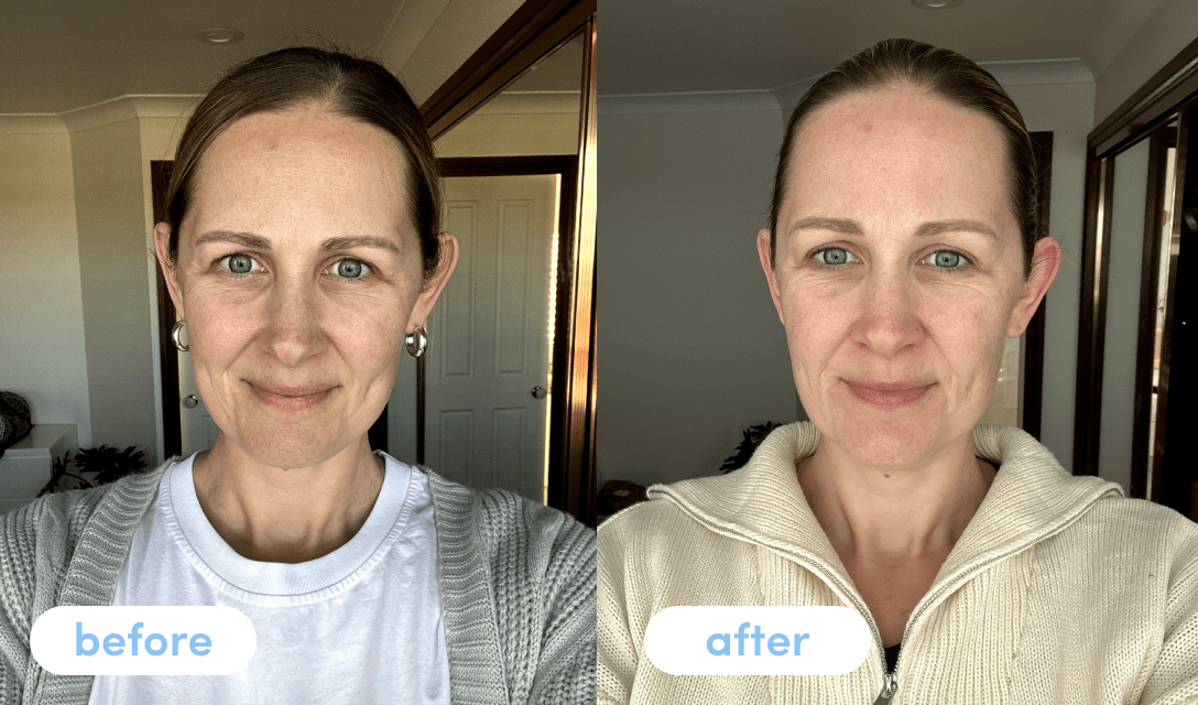 Results – The Collagen Co.