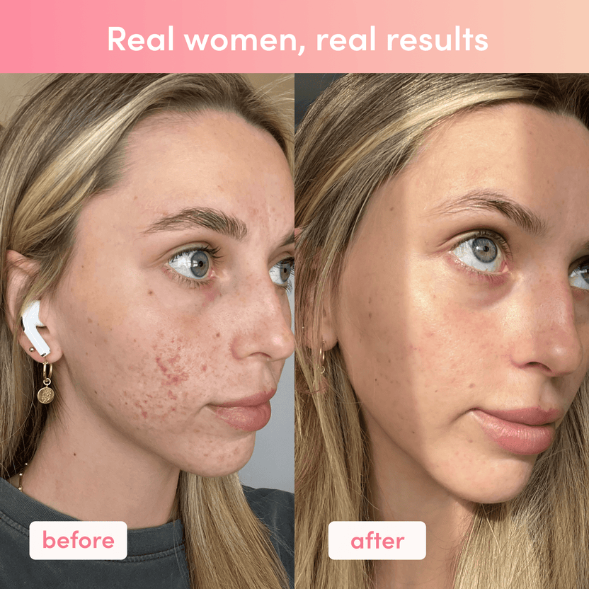 Mixed Berry Collagen Sachets - 280g – The Collagen Co.